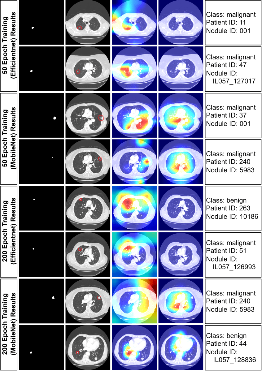 Are Deep Learning Classification Results Obtained on CT Scans Fair and ...